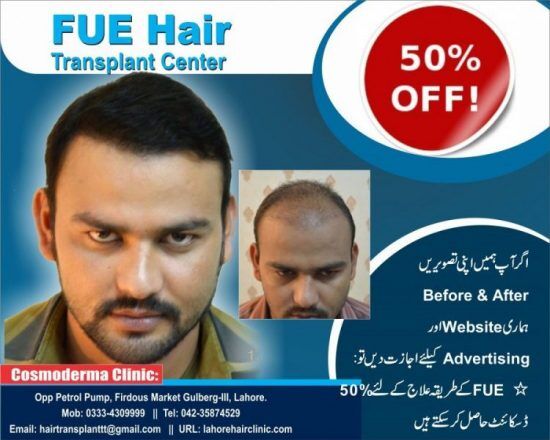 Best Hair Transplant In Lahore Pakistan Specialist Clinic Free Checkup
